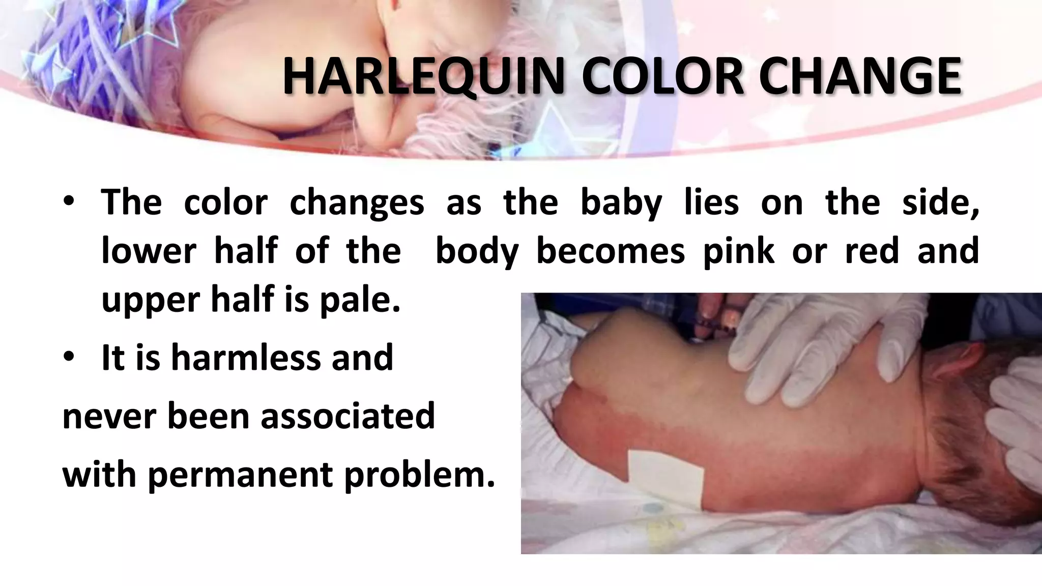 Assessment of newborn | PPTX