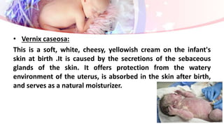 Assessment of newborn | PPTX