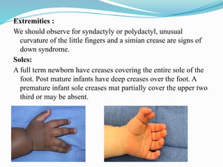 ASSESSMENT OF NEWBORN IN Child health nursing .pptx