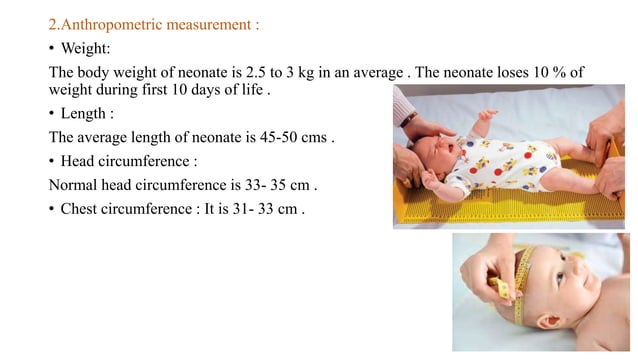 ASSESSMENT OF NEWBORN including ballard score | PPTX