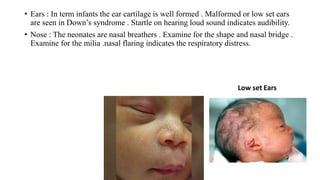 ASSESSMENT OF NEWBORN including ballard score | PPTX