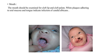 ASSESSMENT OF NEWBORN including ballard score | PPTX