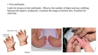 ASSESSMENT OF NEWBORN including ballard score | PPTX