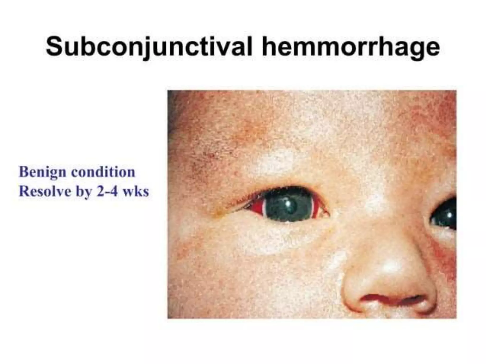 ASSESSMENT OF NORMAL NEONATE.pptx