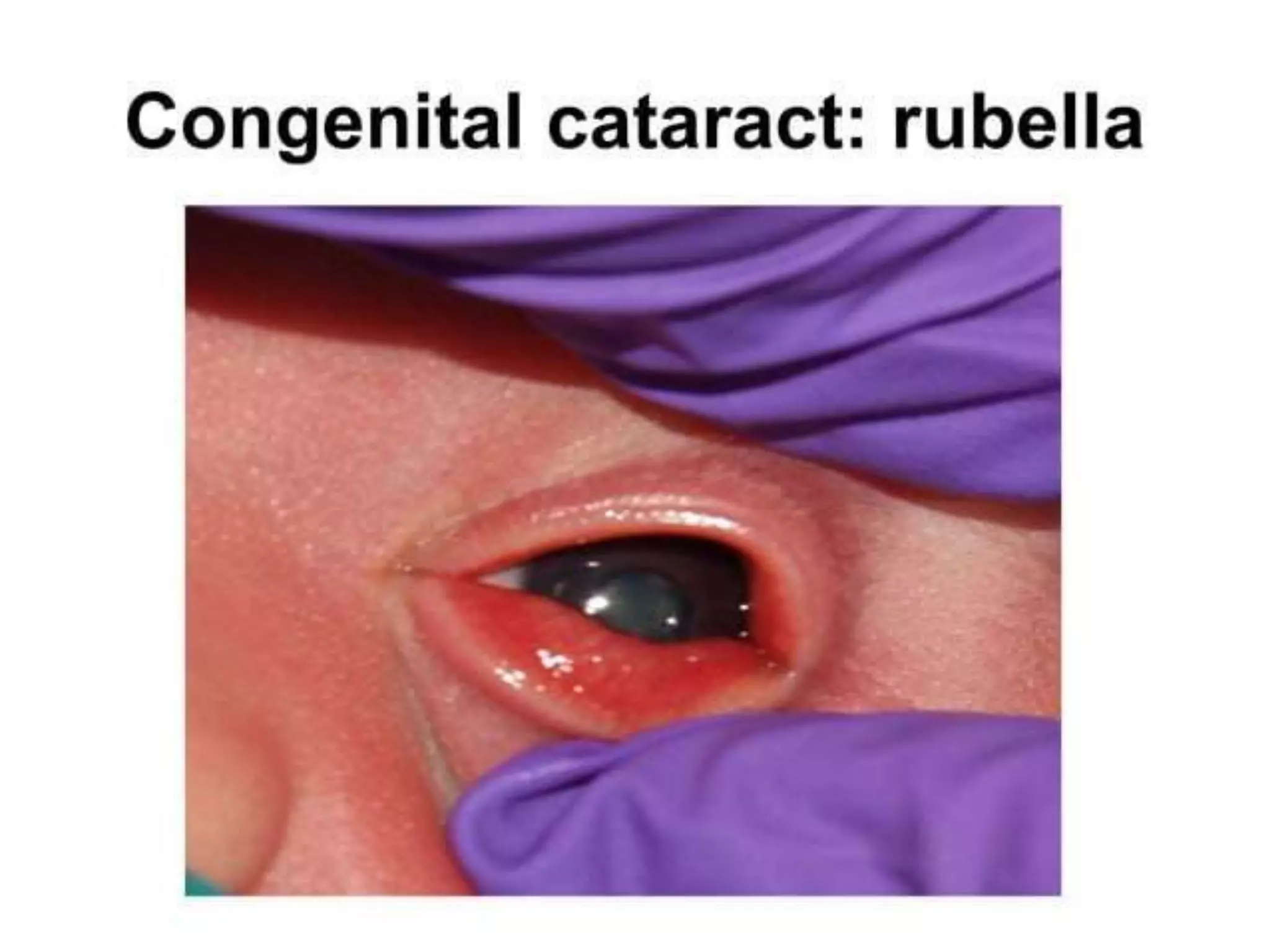 ASSESSMENT OF NORMAL NEONATE.pptx