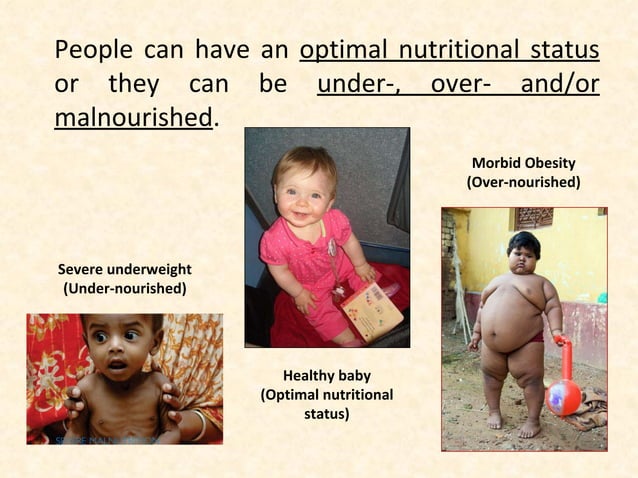 Assessment Of Nutritional Status | PPT | Nutrition | Healthy Living