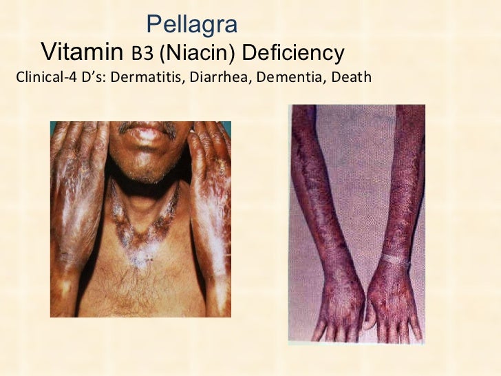 Assessment Of Nutritional Status