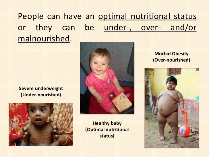 Assessment Of Nutritional Status