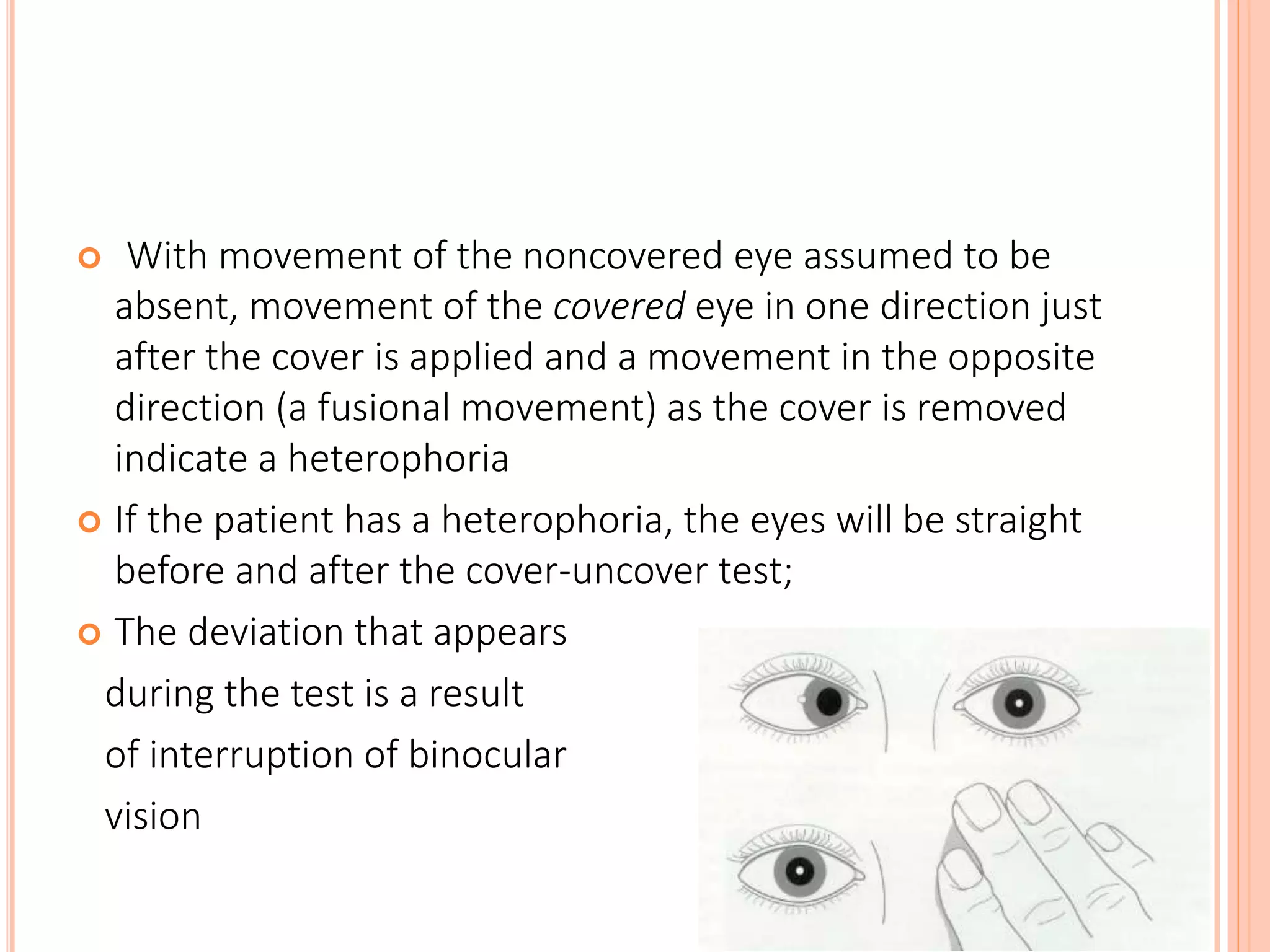 Assessment of ocular alignment | PPTX