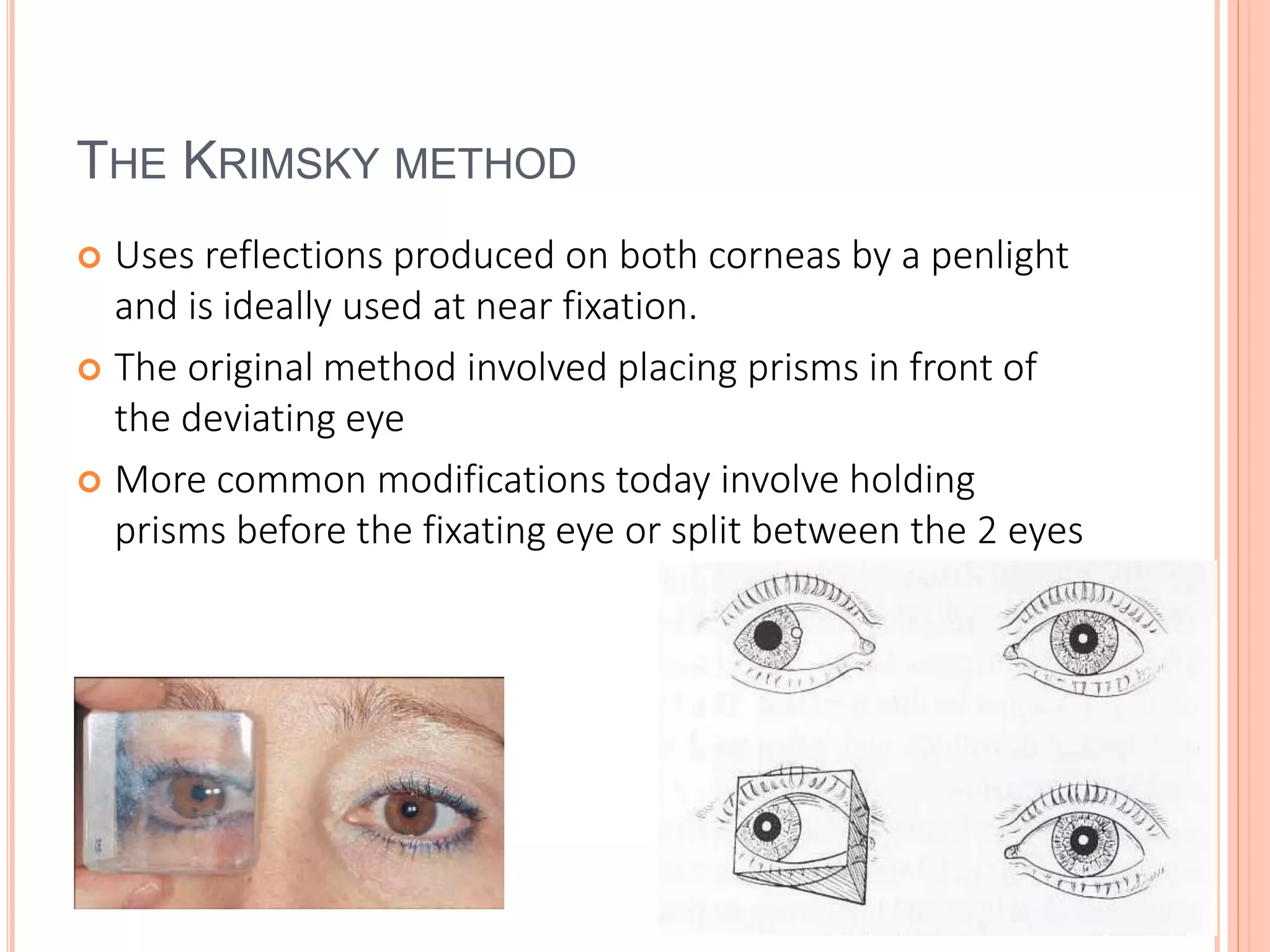 Assessment of ocular alignment | PPTX