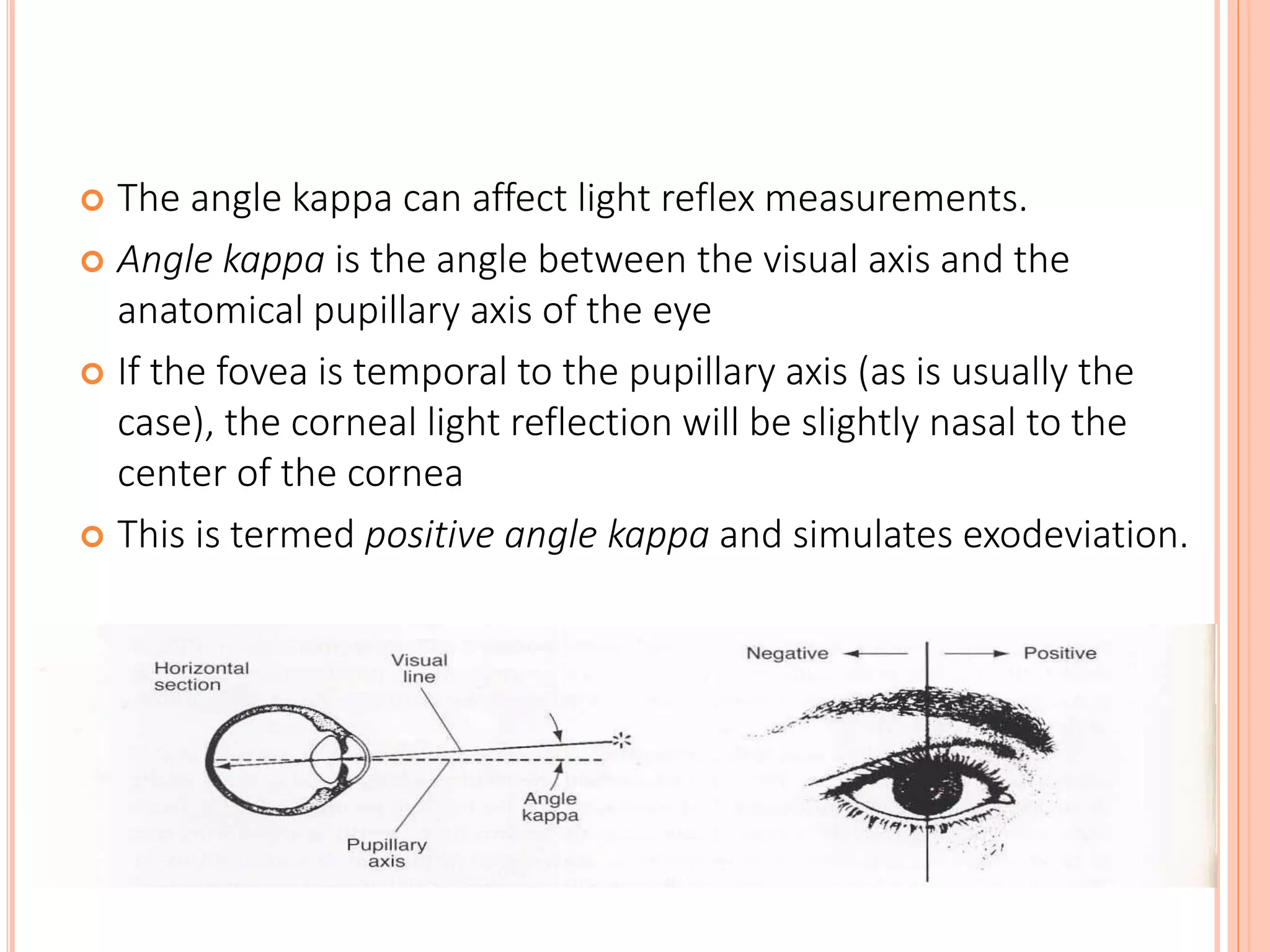 Assessment of ocular alignment | PPTX