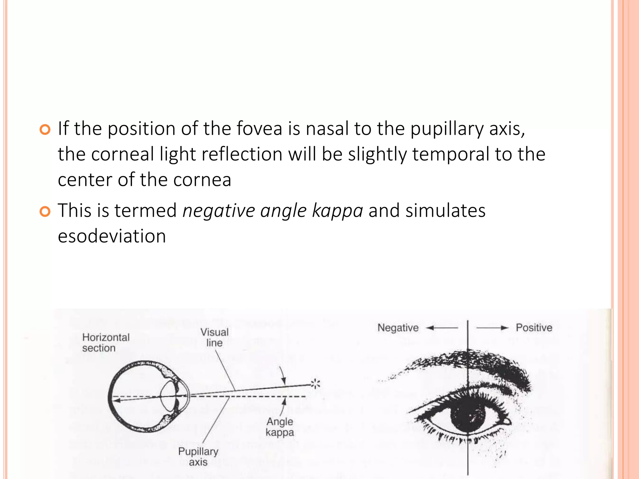 Assessment of ocular alignment | PPTX