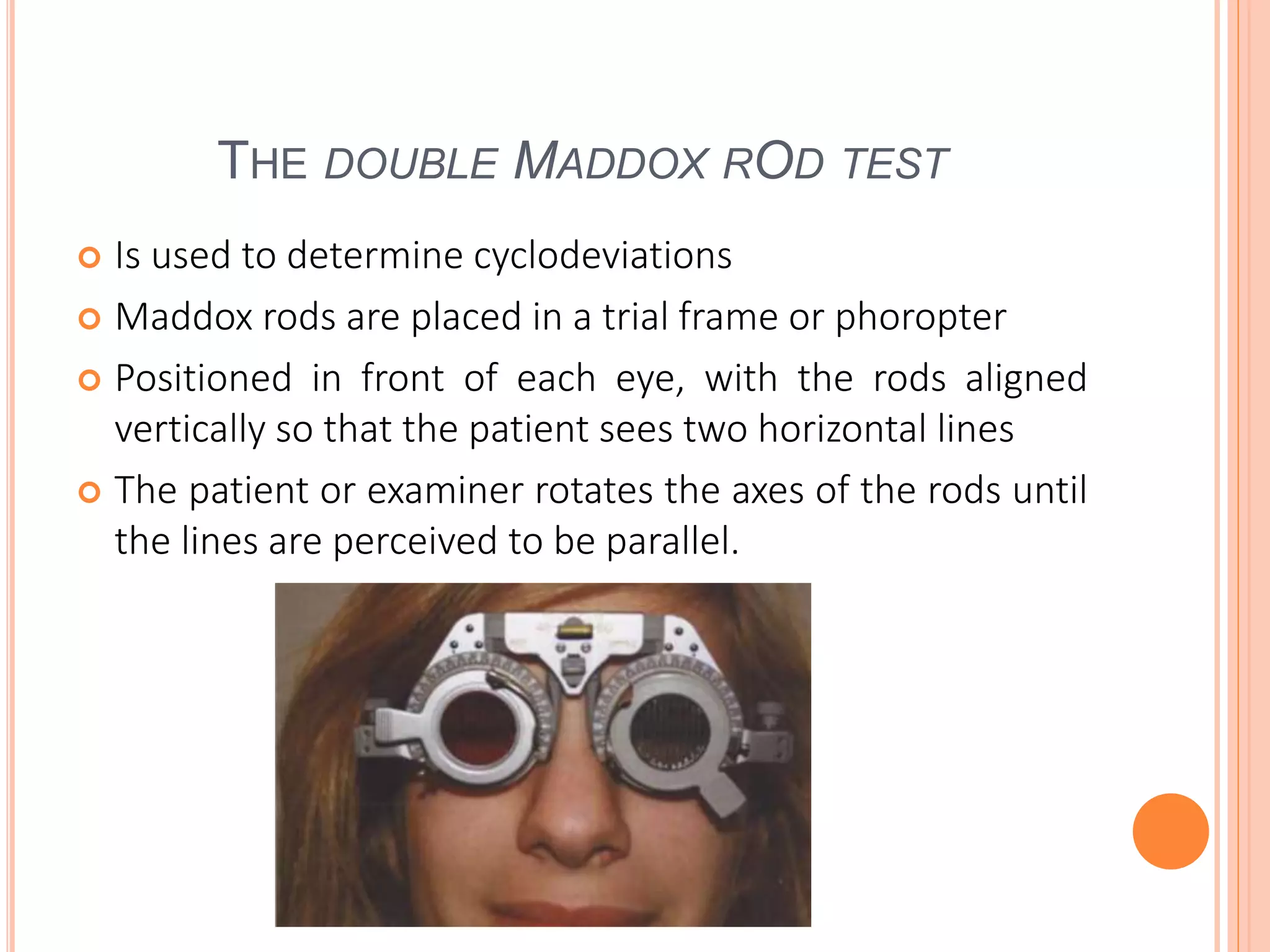 Assessment of ocular alignment | PPTX