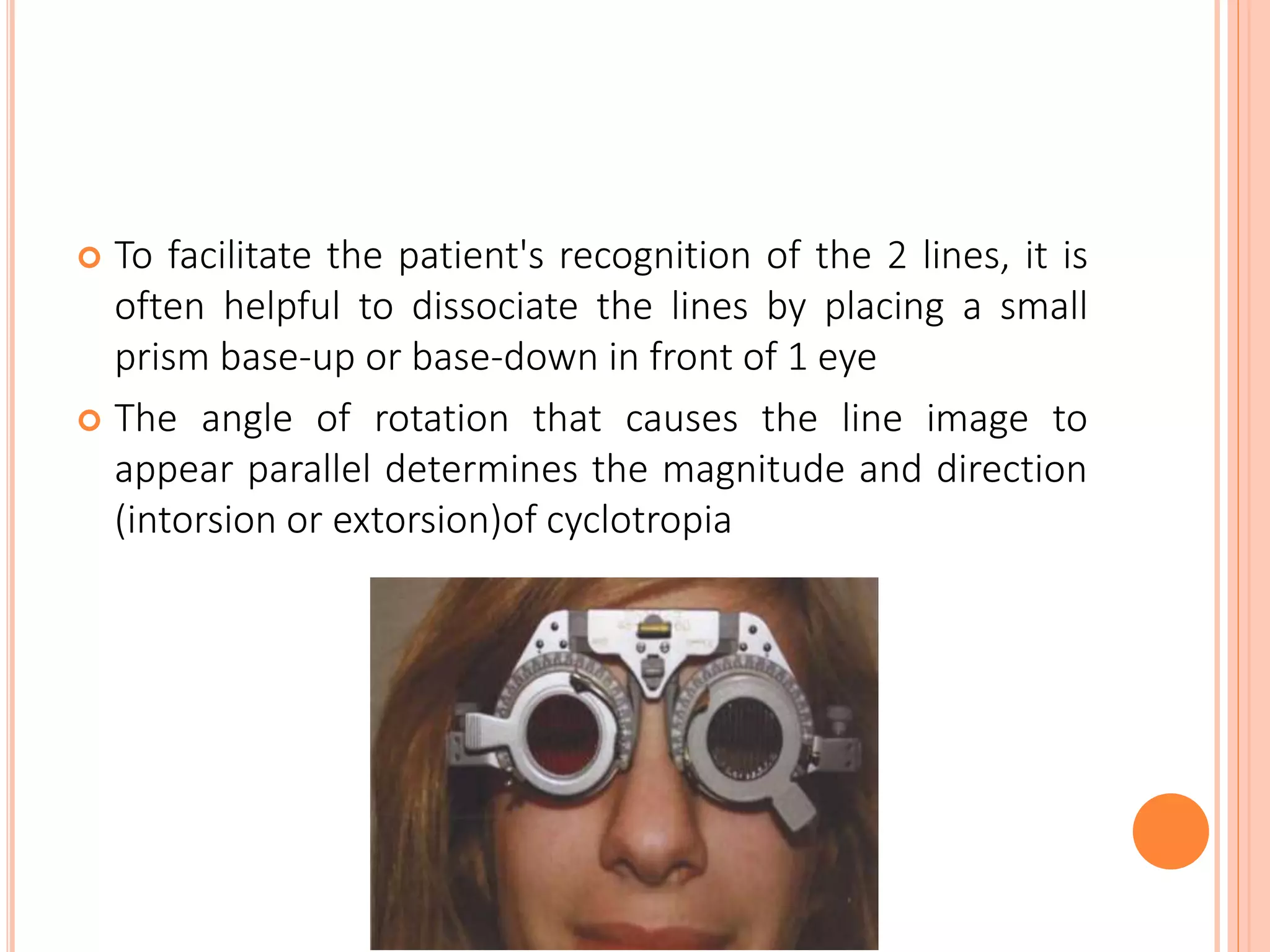 Assessment of ocular alignment | PPTX