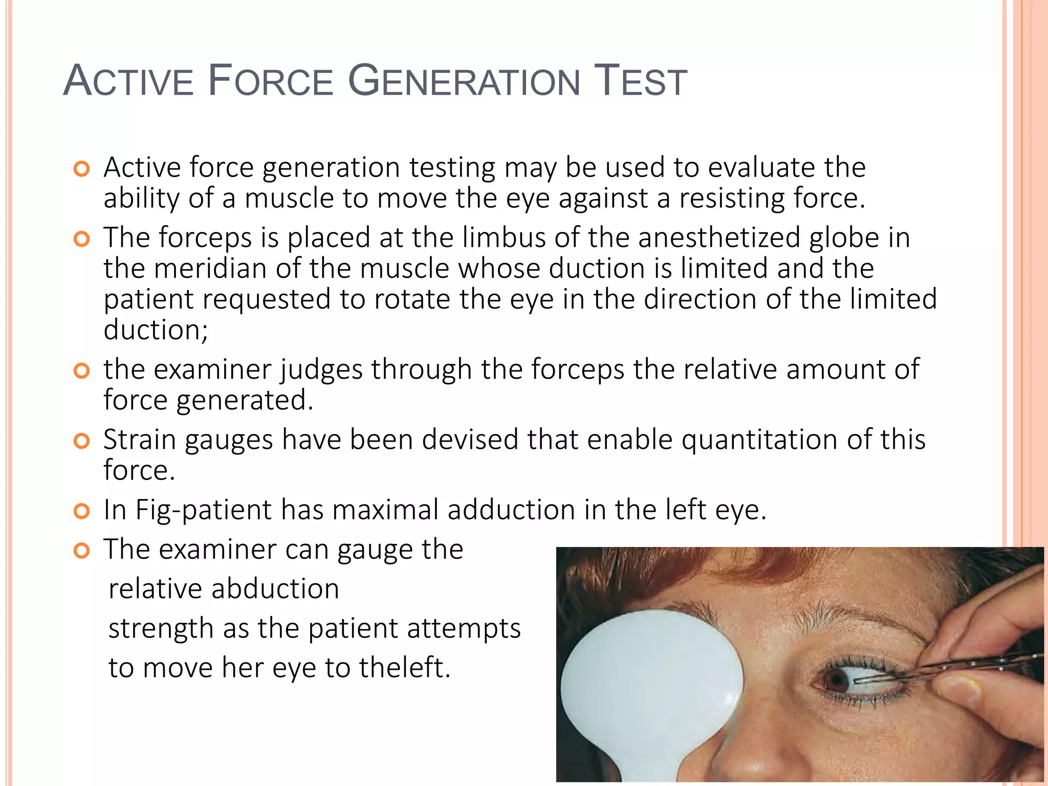 Assessment of ocular alignment | PPTX