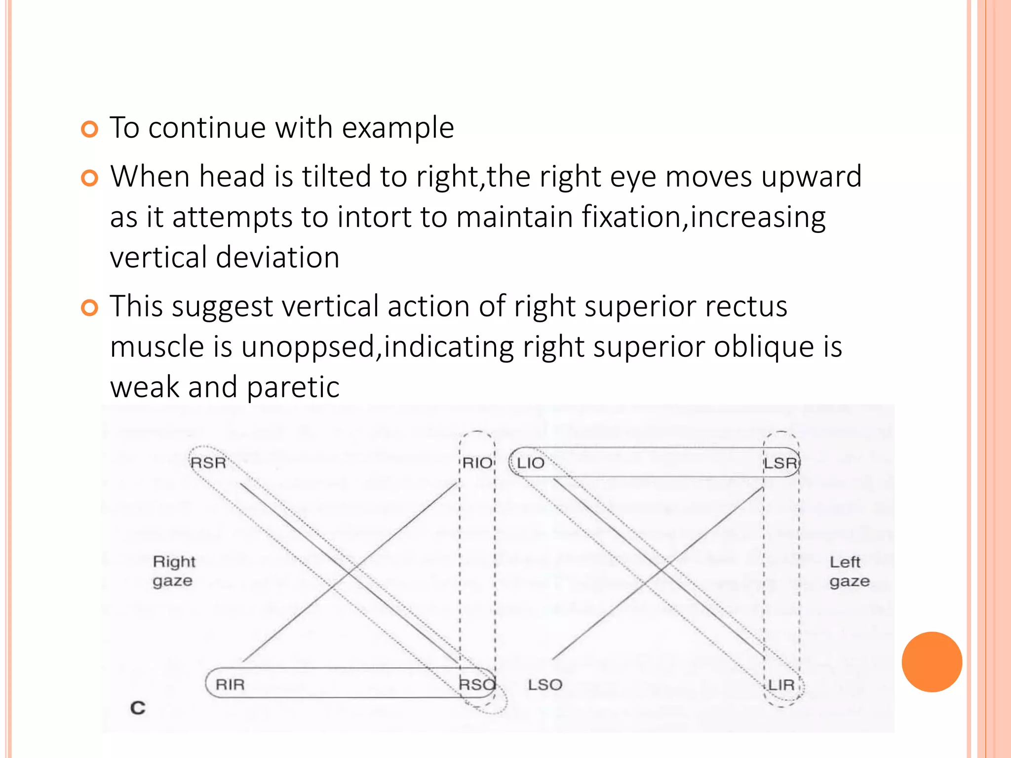 Assessment of ocular alignment | PPTX