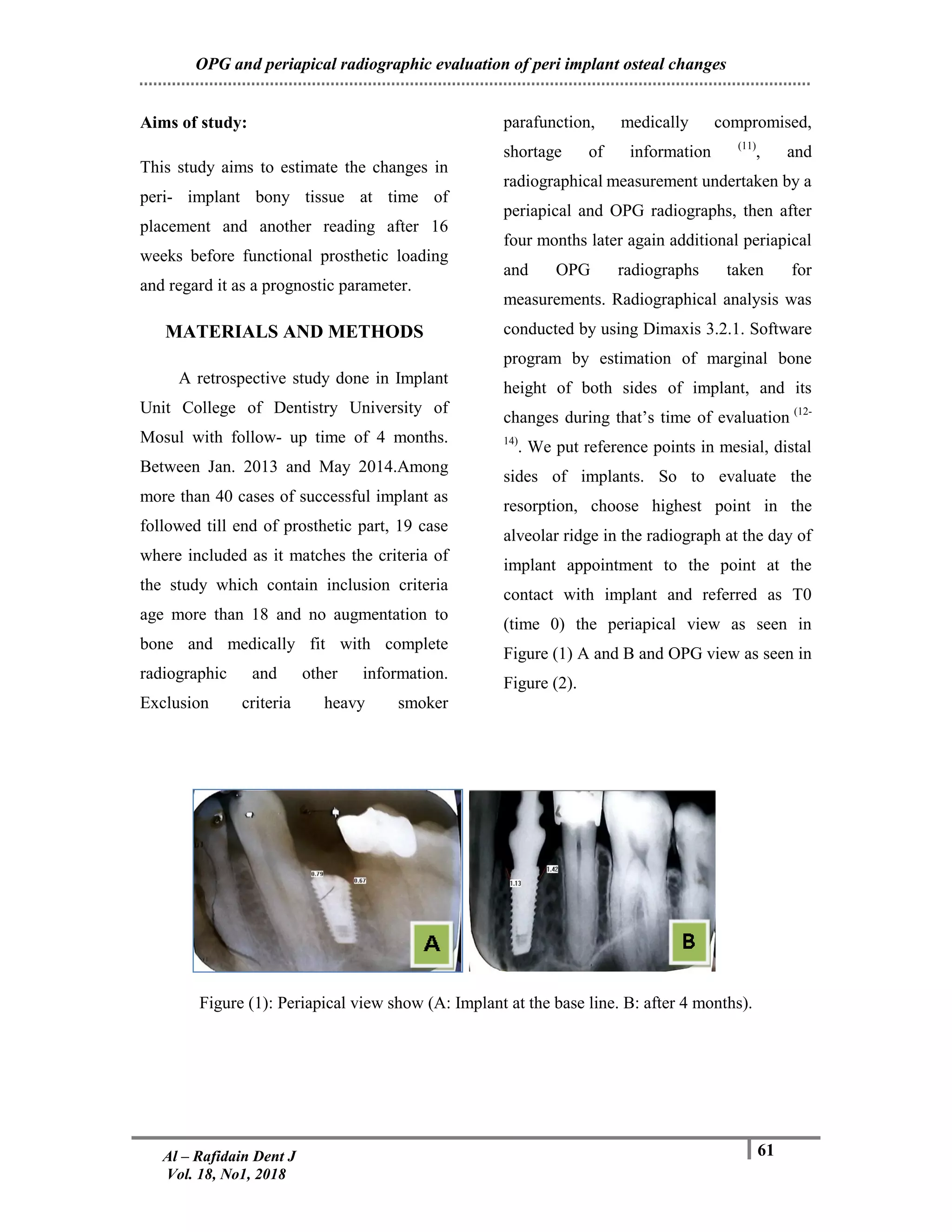 Assessment of peri implant osteal changes by radiographic evaluation ...