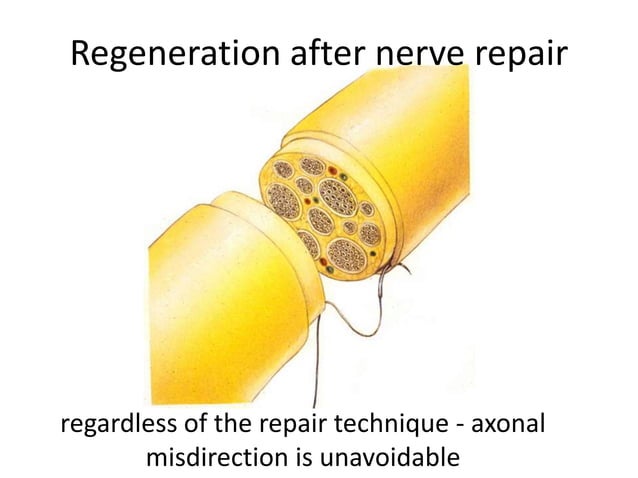 Assessment of peripheral nerve surgery | PPT