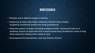 Assessment of physical abuse.pdf