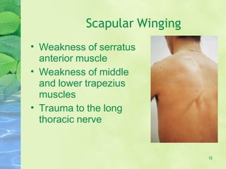 Methods in assessing posture and its abnormality | PPT