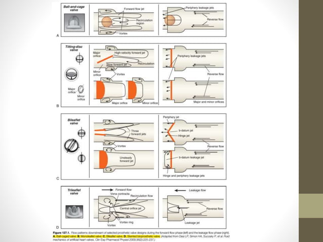 Assessment of prosthetic valve function | PPTX