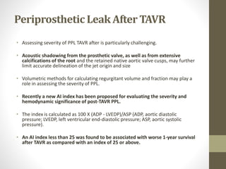 Assessment of prosthetic valve function | PPTX
