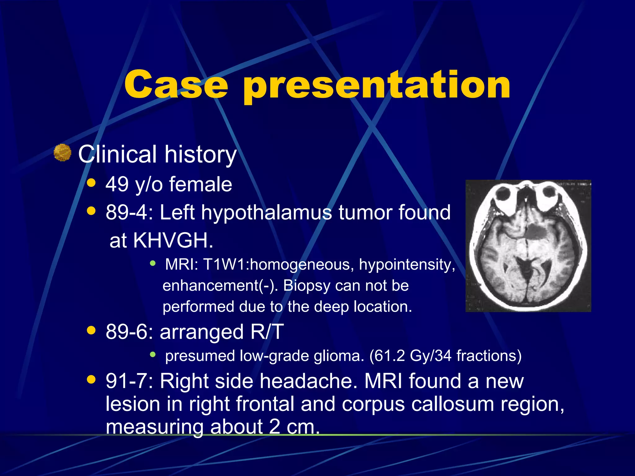 Assessment Of Recurrent Brain Tumor | PPT