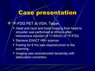 Assessment Of Recurrent Brain Tumor | PPT