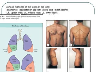 Assessment of respiratory system | PPT