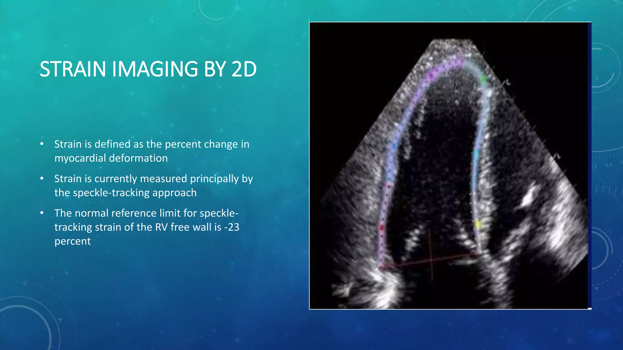 Assessment of rv function | PPTX