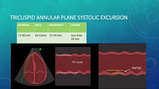 Assessment of rv function | PPTX