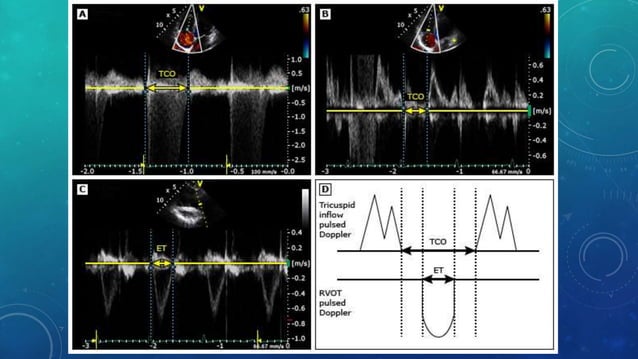 Assessment of rv function | PPTX | Heart and Cardiovascular Diseases ...