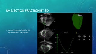 Assessment of rv function | PPTX