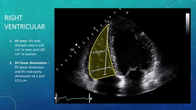 Assessment of rv function | PPTX | Heart and Cardiovascular Diseases ...