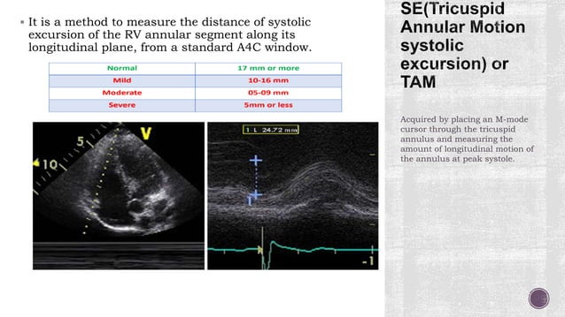 ASSESSMENT OF RV FUNCTION.pptx | Heart and Cardiovascular Diseases ...
