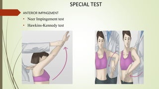 Assessment of shoulder | PPTX