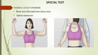 Assessment of shoulder | PPTX