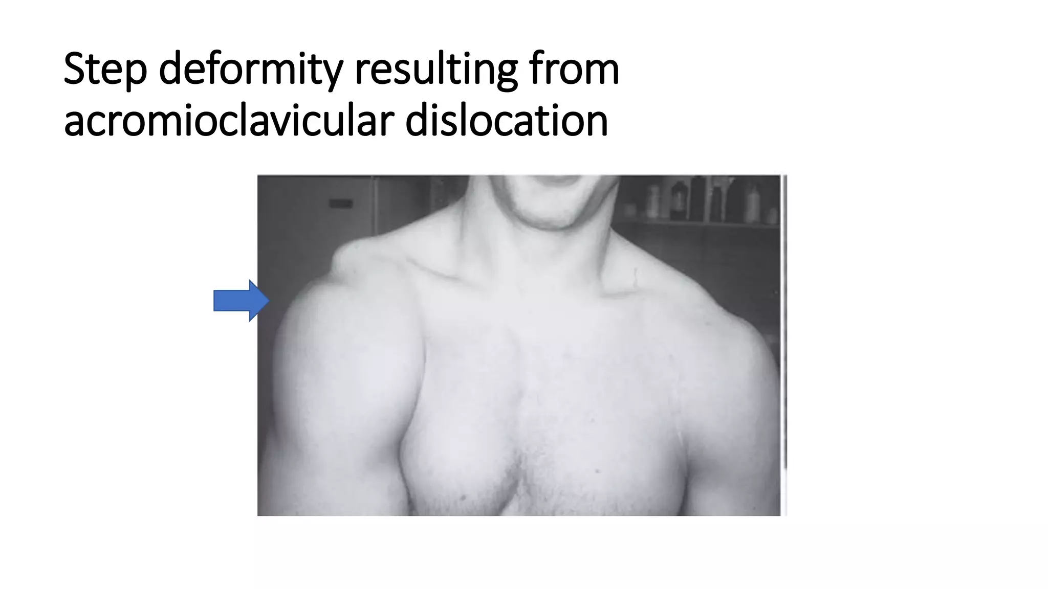 Assessment of shoulder joint | PPT