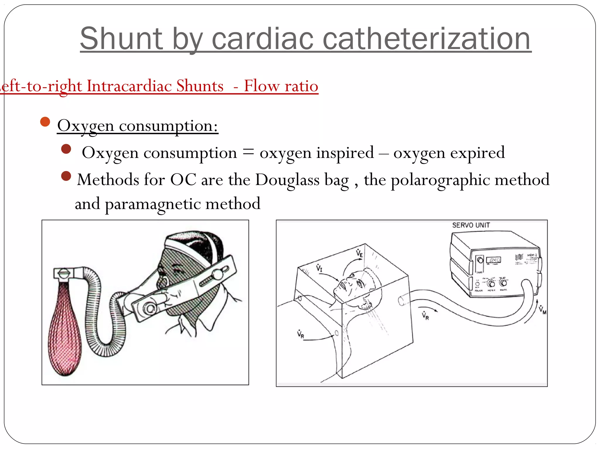 Assessment of shunt by cardiac catheterization | PPT