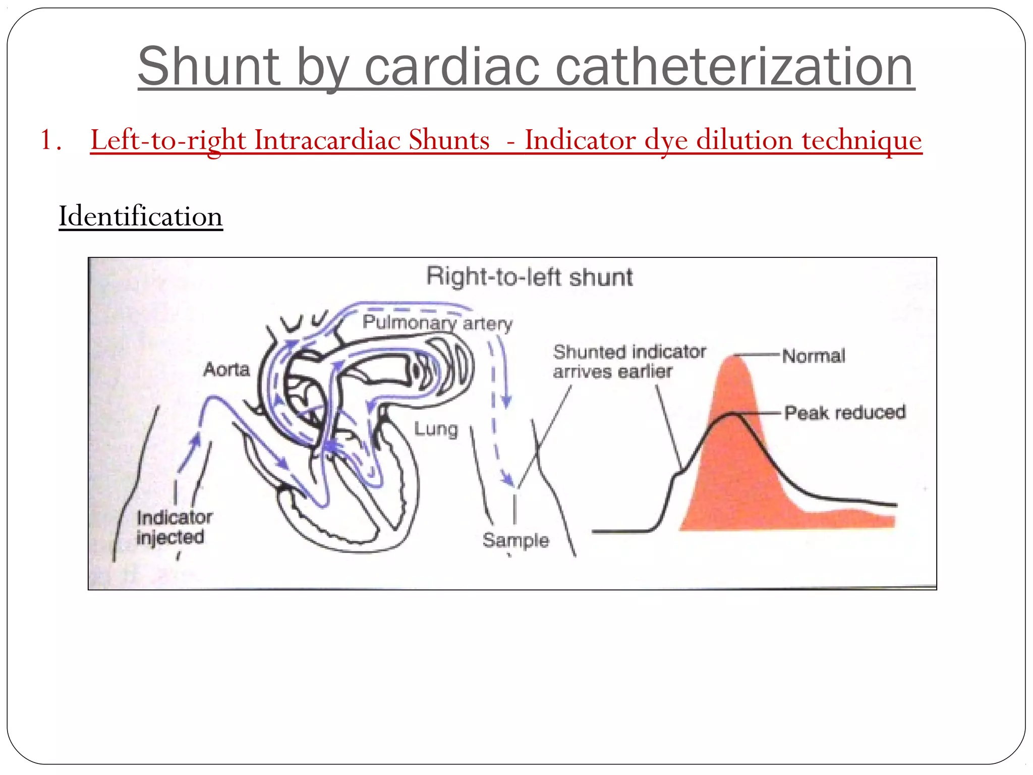 Assessment of shunt by cardiac catheterization | PPT