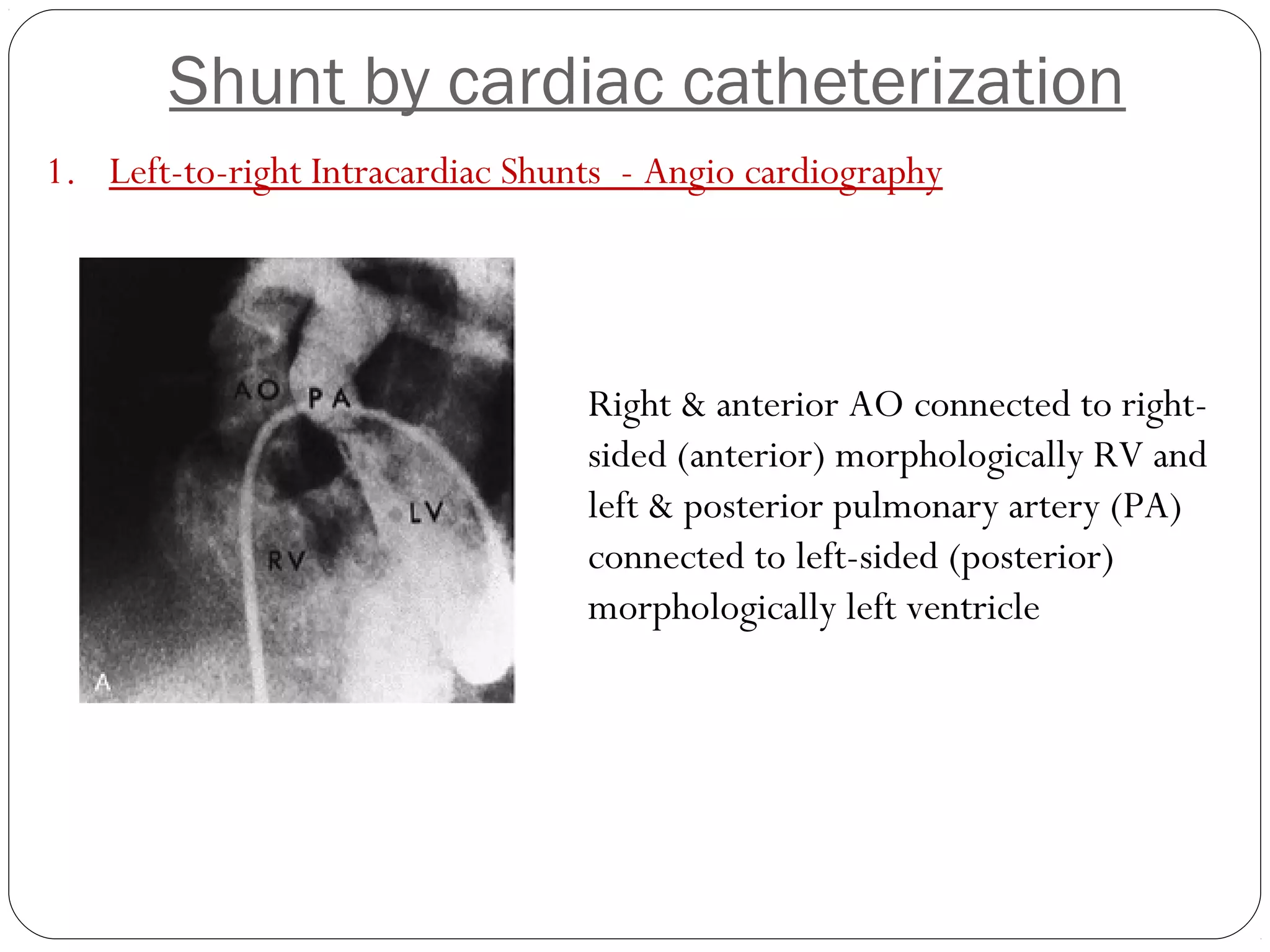 Assessment of shunt by cardiac catheterization | PPT