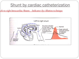 Assessment of shunt by cardiac catheterization | PPT