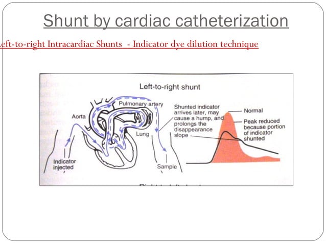 Assessment of shunt by cardiac catheterization | PPT | Heart and ...
