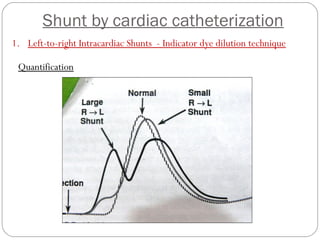 Assessment of shunt by cardiac catheterization | PPT