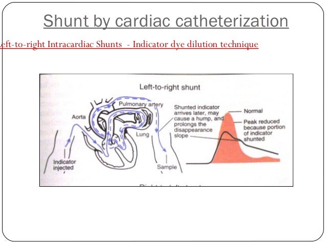 Assessment of shunt by cardiac catheterization