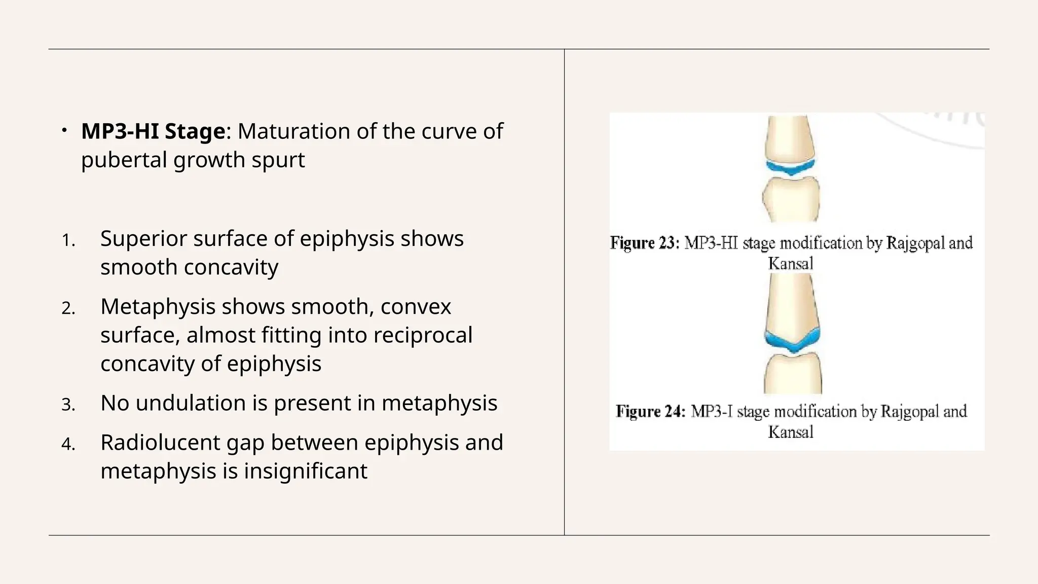 Assessment of skeletal age in Orthodontics | PPTX
