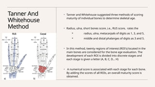 Assessment of skeletal age in Orthodontics | PPTX