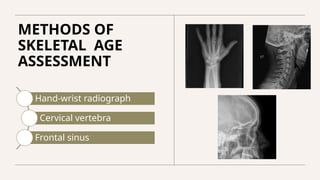 Assessment of skeletal age in Orthodontics | PPTX