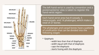 Assessment of skeletal age in Orthodontics | PPTX