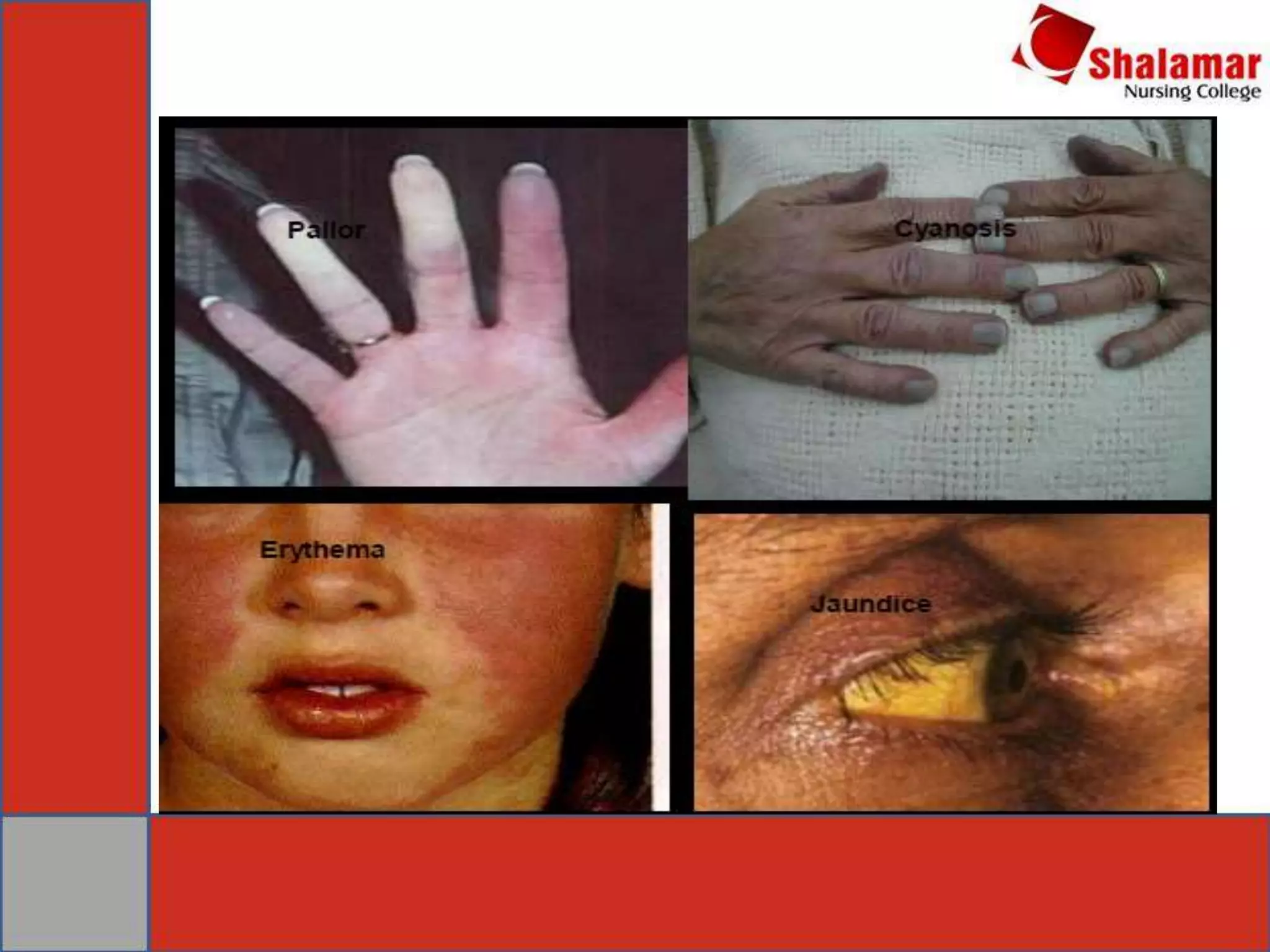 Assessment of Skin, Hairs & Nails. | PPTX